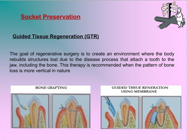 Orthodontic consideration of the old extraction site | PPT | Bone and ...