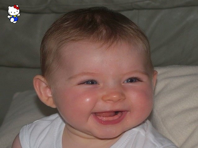 Orthodontic consideration of the old extraction site | PPT | Bone and ...