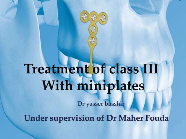 Orthodontic correction of early class iii with miniplates | PPTX