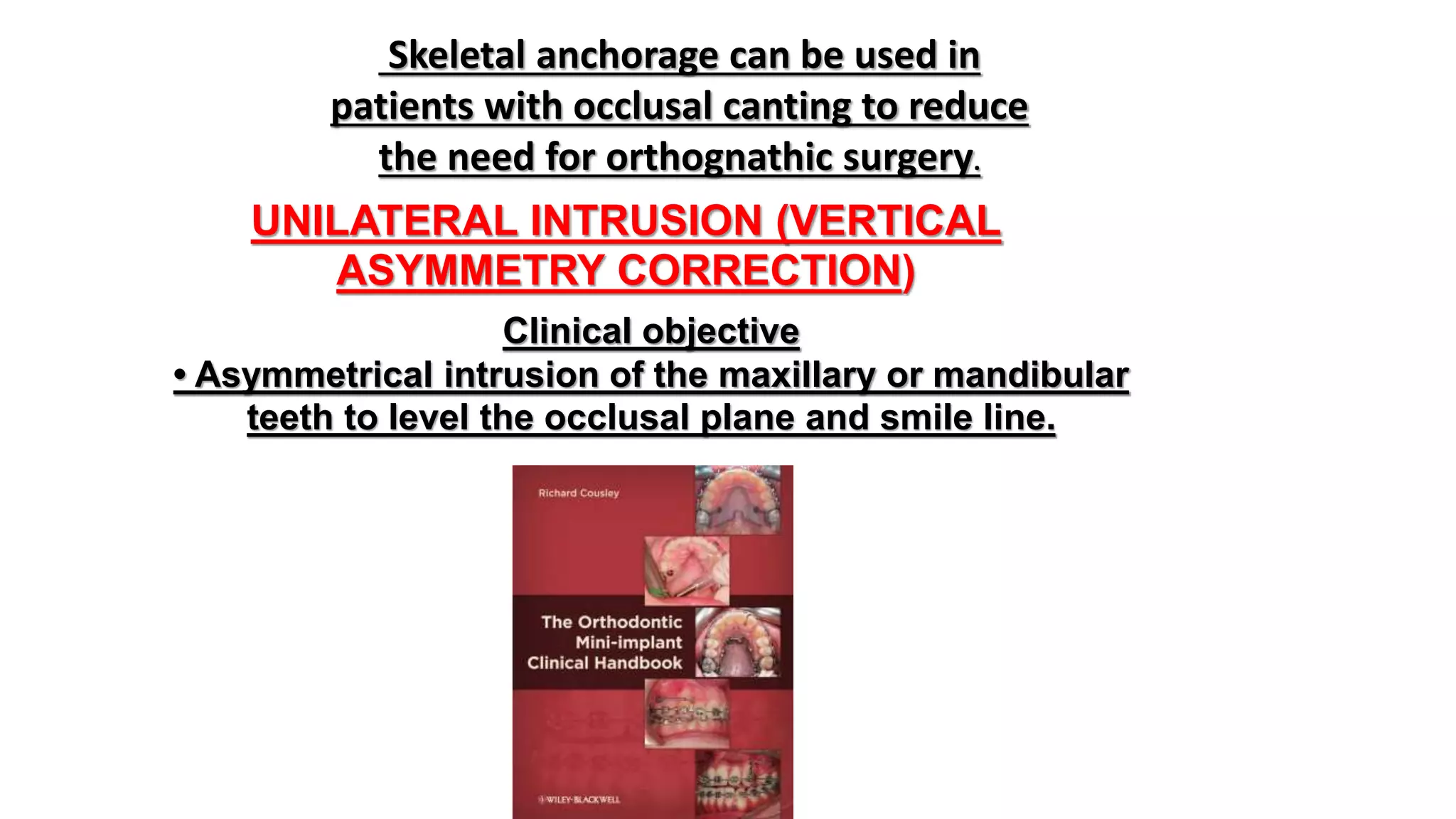 Orthodontic correction of occlusal plane canting part 1 | PPTX | Dental Health | Diseases and ...