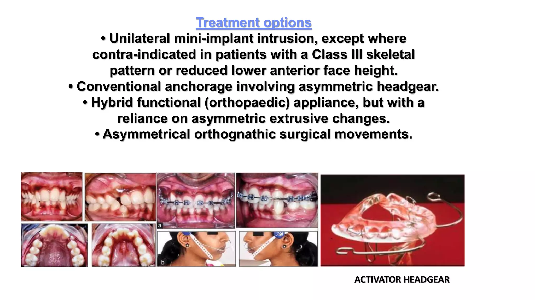 Orthodontic correction of occlusal plane canting part 1 | PPTX