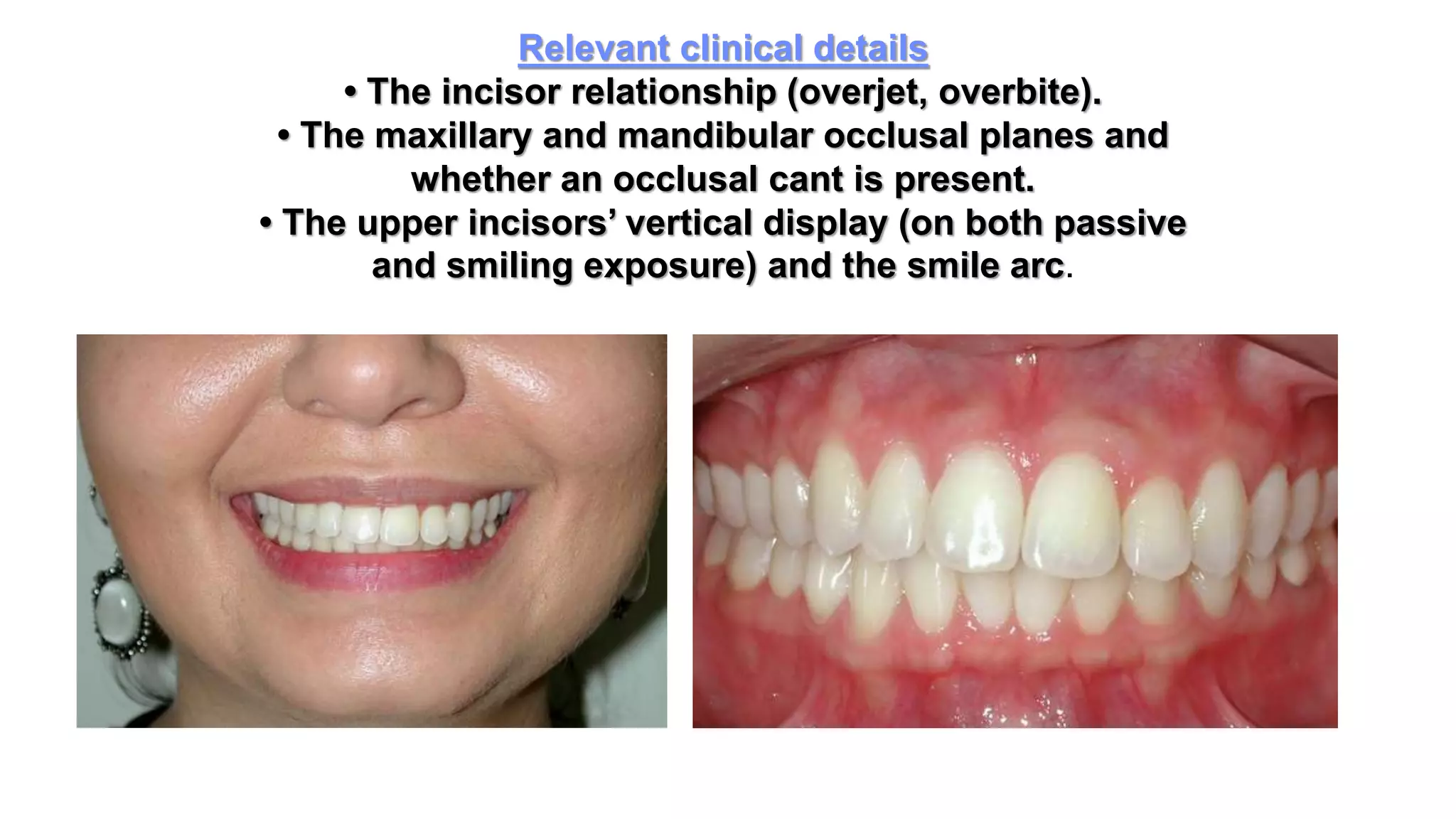 Orthodontic correction of occlusal plane canting part 1 | PPTX | Dental Health | Diseases and ...
