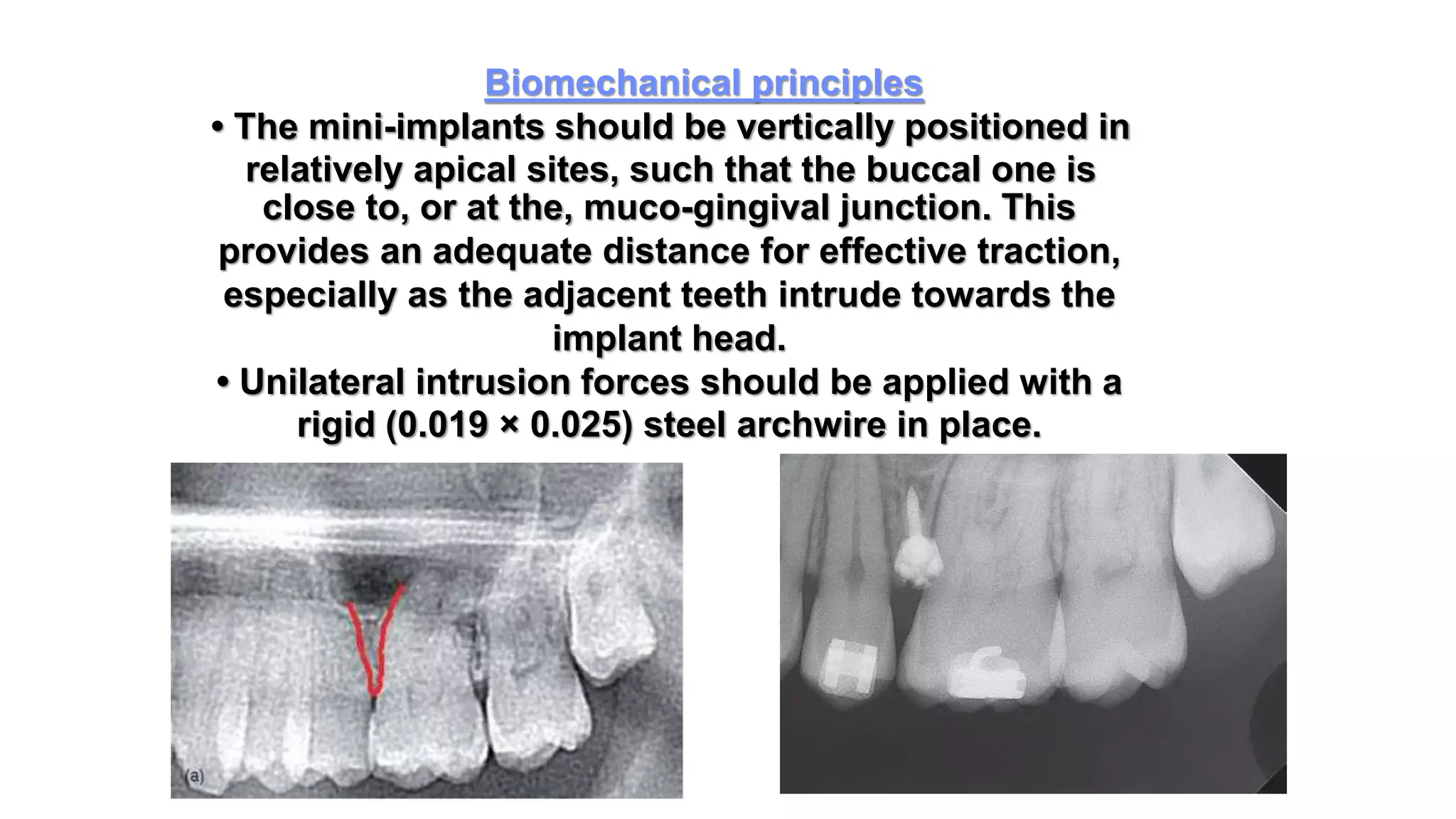 Orthodontic correction of occlusal plane canting part 1 | PPTX