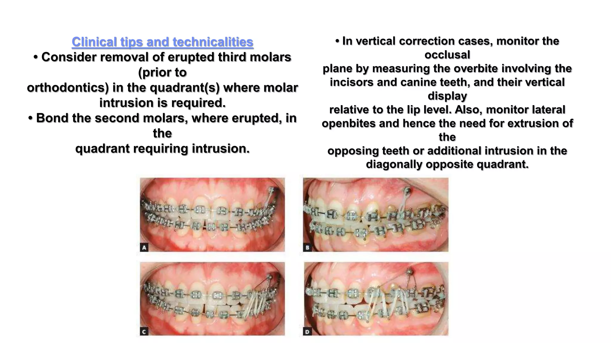 Orthodontic correction of occlusal plane canting part 1 | PPTX | Dental Health | Diseases and ...