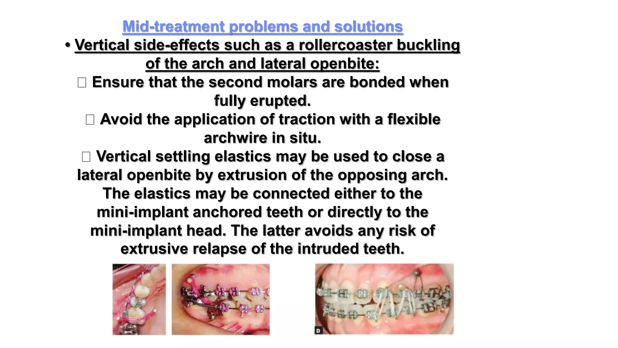 Orthodontic correction of occlusal plane canting part 1 | PPTX