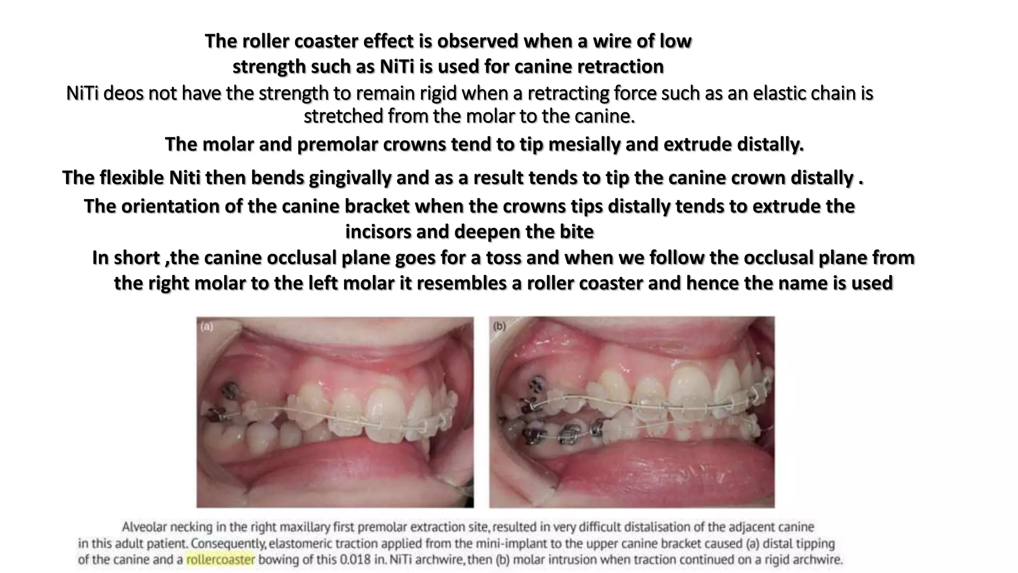 Orthodontic correction of occlusal plane canting part 1 | PPTX