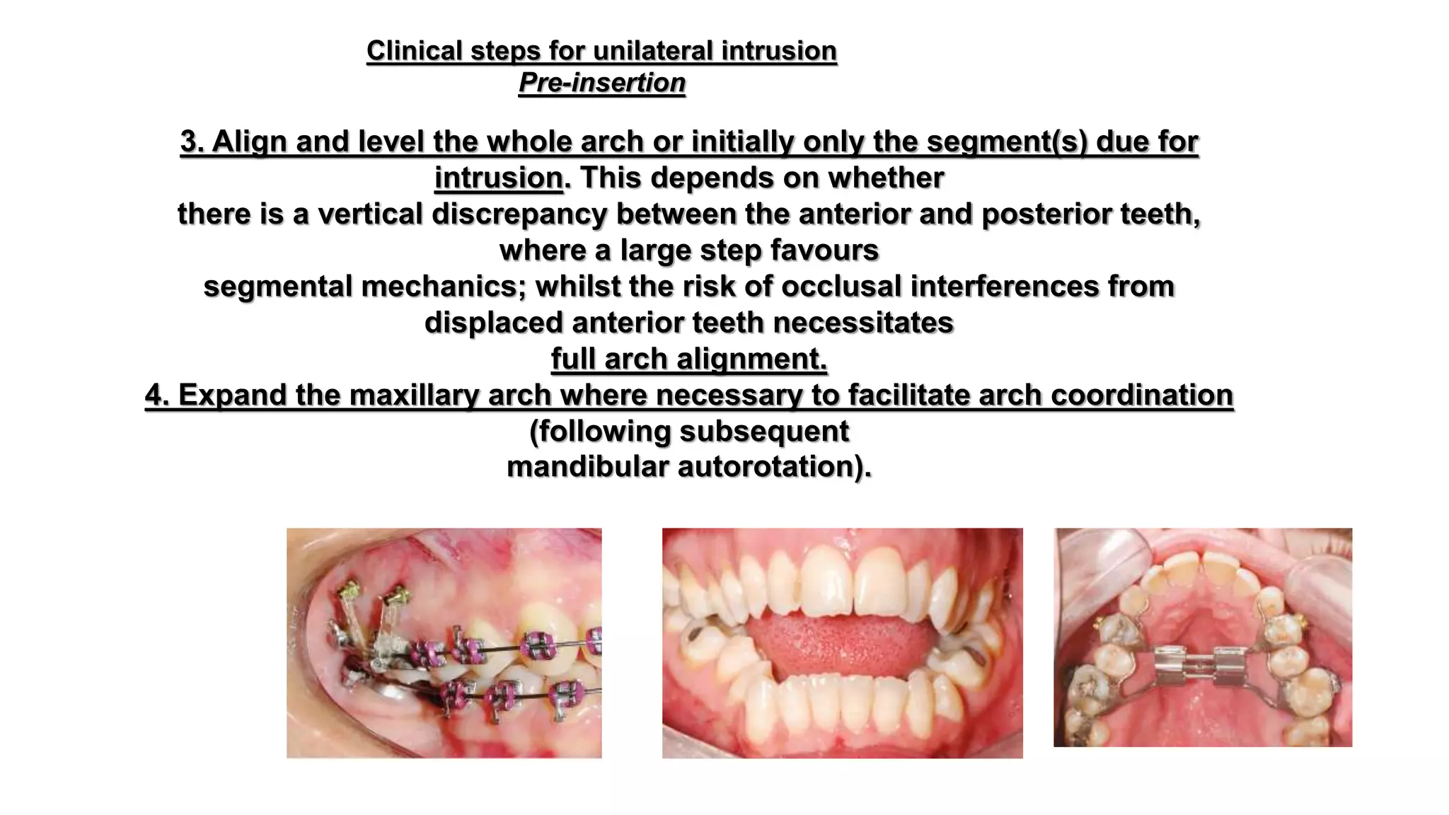 Orthodontic correction of occlusal plane canting part 1 | PPTX | Dental Health | Diseases and ...