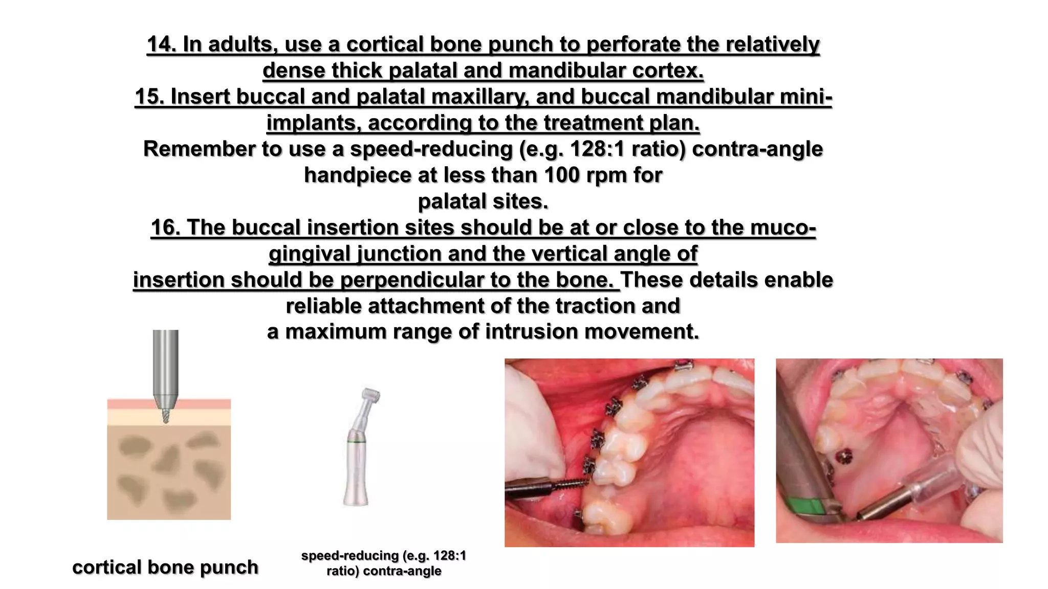 Orthodontic correction of occlusal plane canting part 1 | PPTX | Dental Health | Diseases and ...