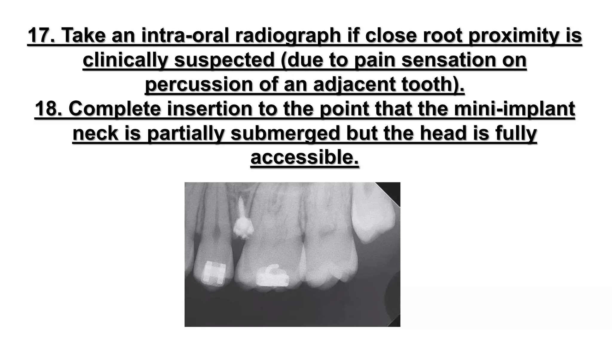 Orthodontic correction of occlusal plane canting part 1 | PPTX