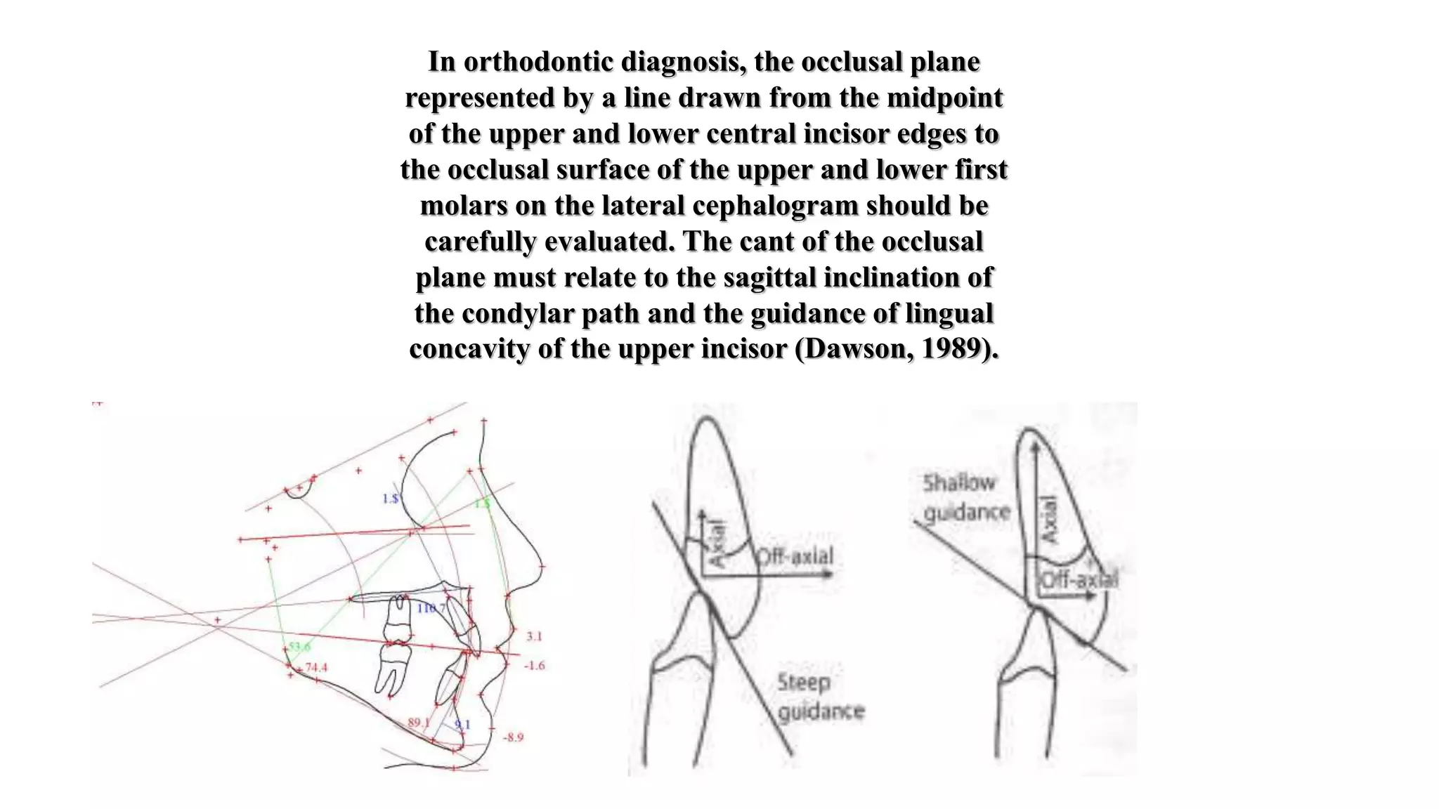 Orthodontic correction of occlusal plane canting part 1 | PPTX