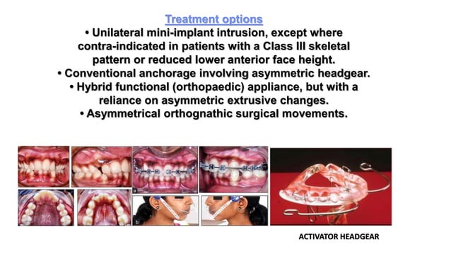 Orthodontic correction of occlusal plane canting part 1 | PPTX | Dental ...