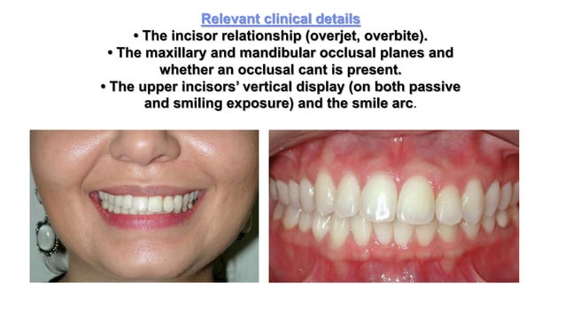 Orthodontic correction of occlusal plane canting part 1 | PPTX | Dental ...