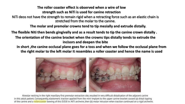 Orthodontic correction of occlusal plane canting part 1 | PPTX | Dental ...