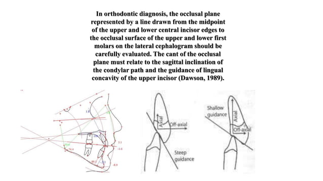 Orthodontic correction of occlusal plane canting part 1 | PPTX | Dental ...