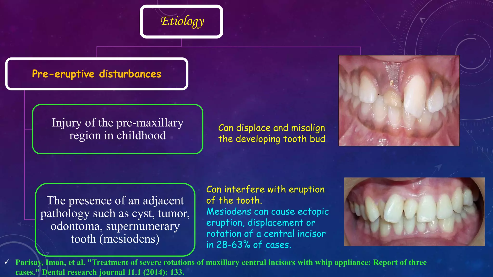 Orthodontic Correction of Rotated Teeth | PPTX | Dental Health ...