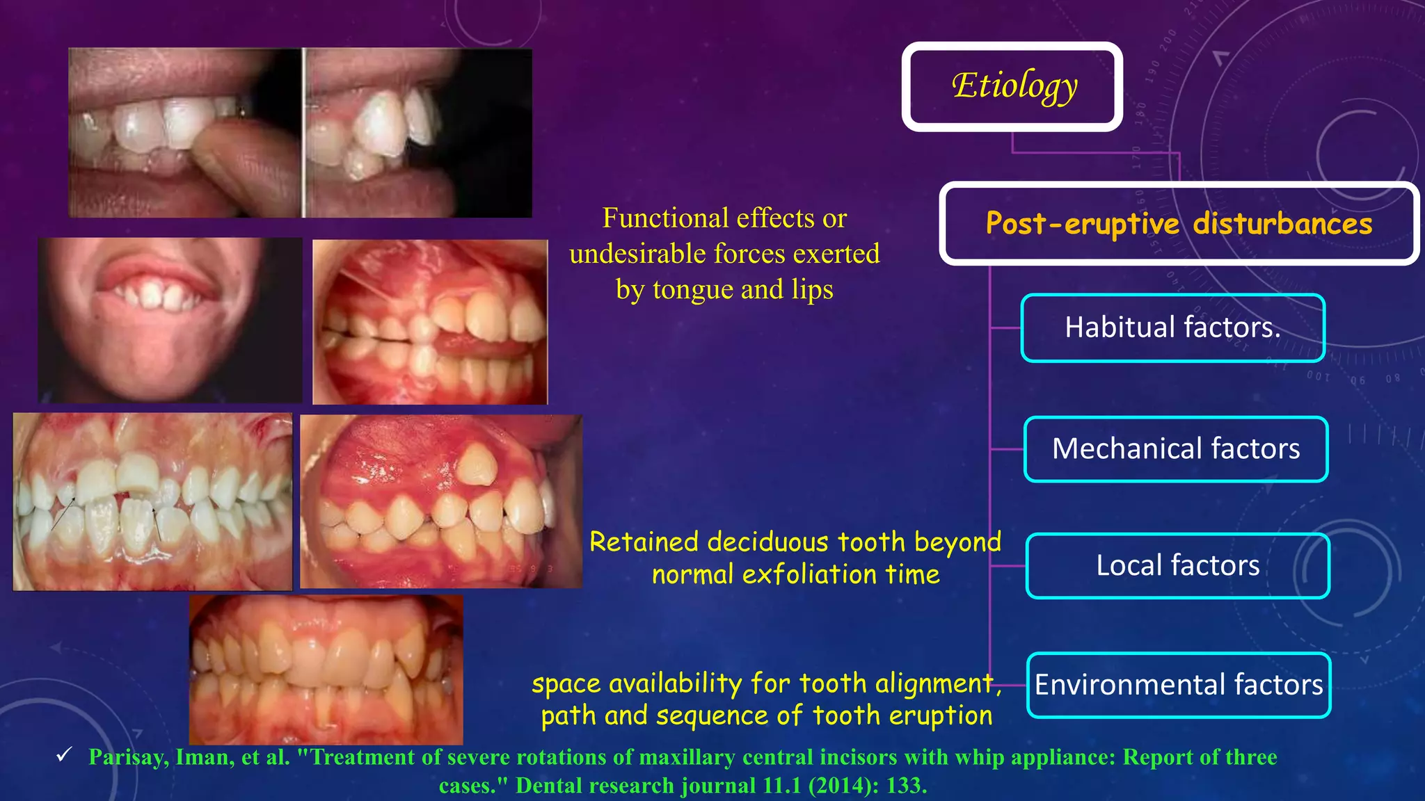 Orthodontic Correction of Rotated Teeth | PPTX