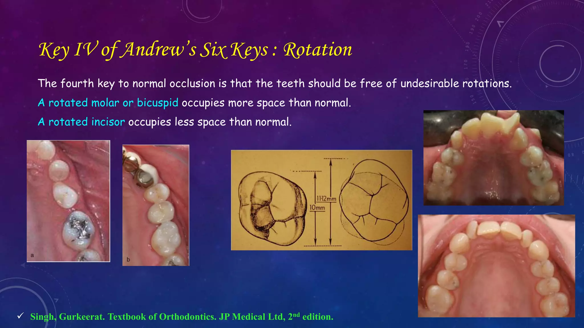 Orthodontic Correction of Rotated Teeth | PPTX