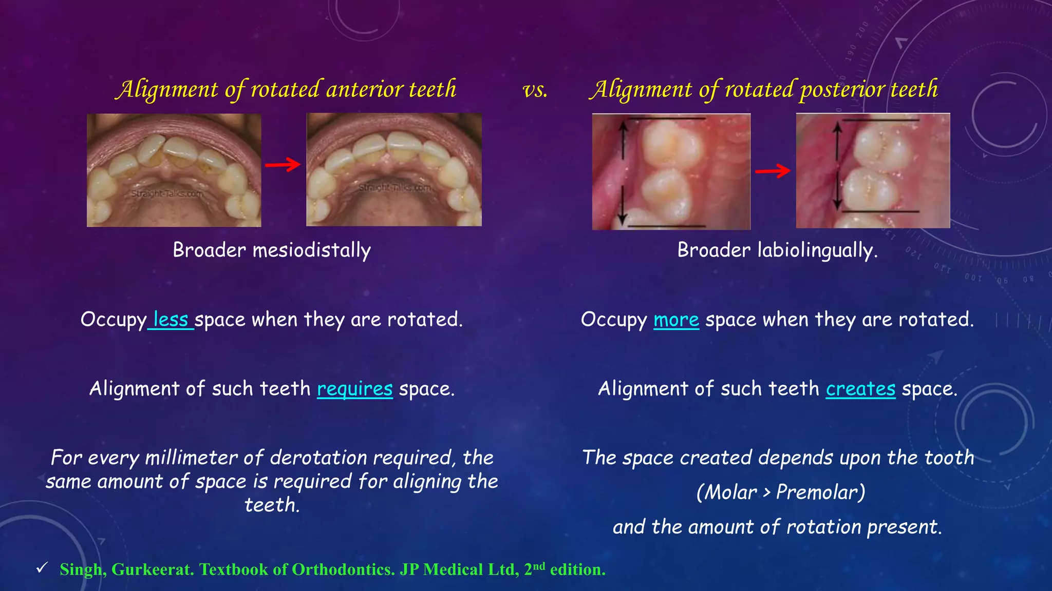 Orthodontic Correction of Rotated Teeth | PPTX