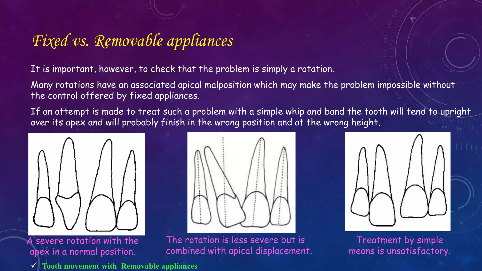 Orthodontic Correction of Rotated Teeth | PPTX
