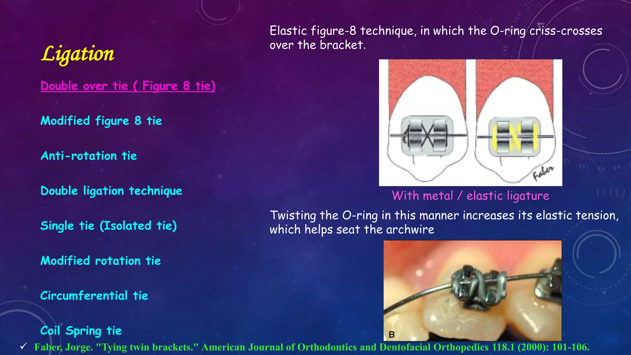 Orthodontic Correction of Rotated Teeth | PPTX