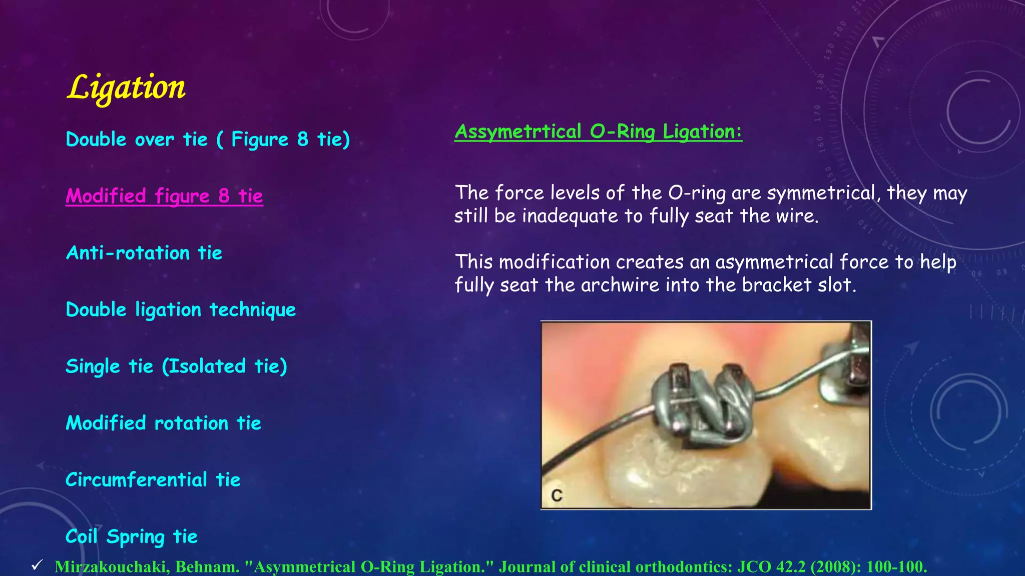 Orthodontic Correction of Rotated Teeth | PPTX