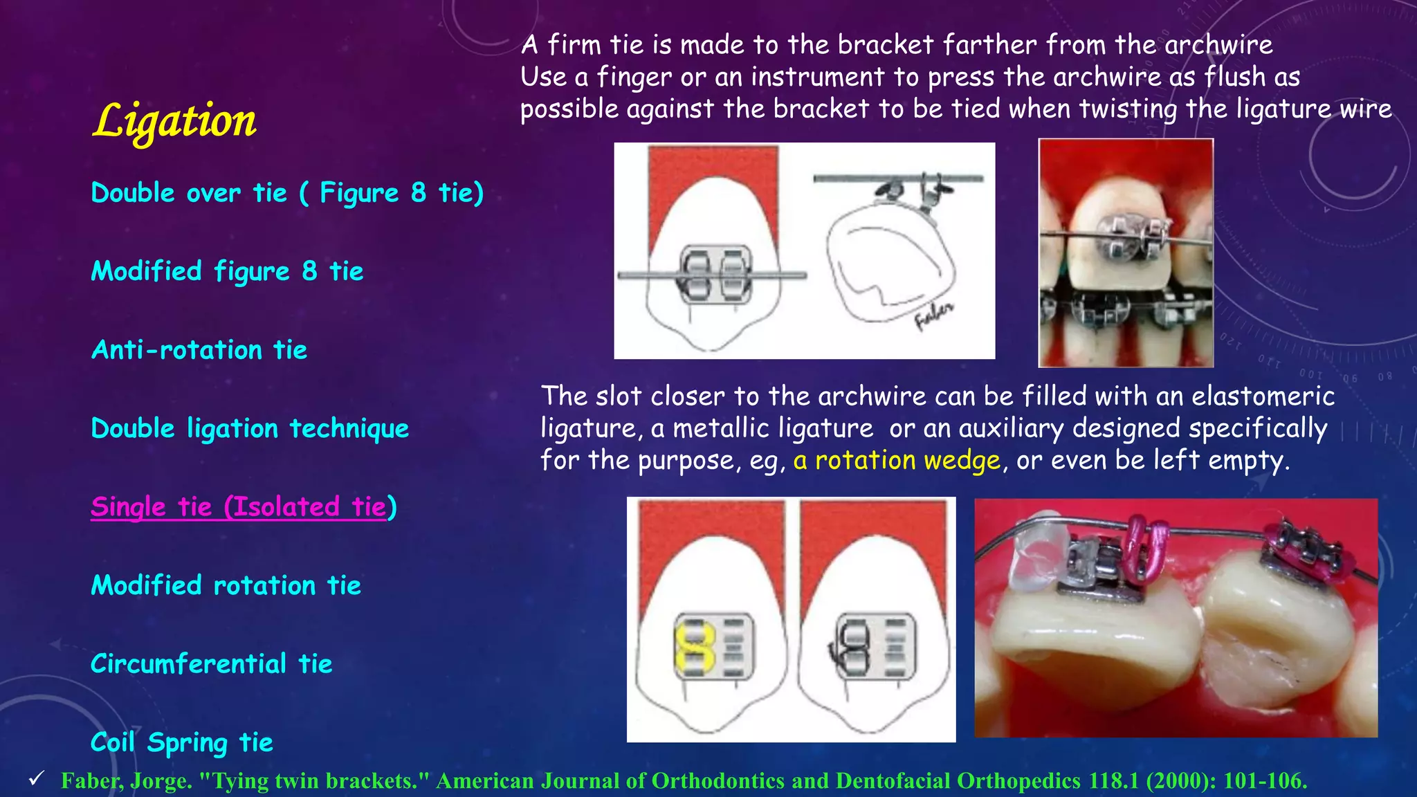 Orthodontic Correction of Rotated Teeth | PPTX