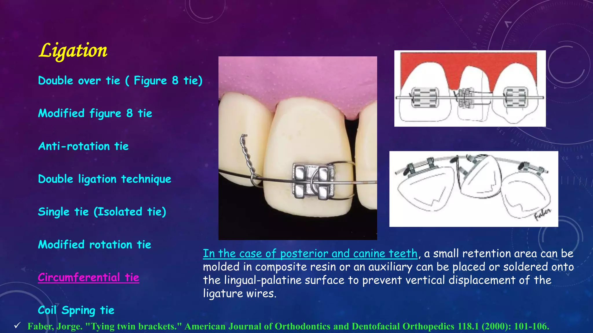 Orthodontic Correction of Rotated Teeth | PPTX