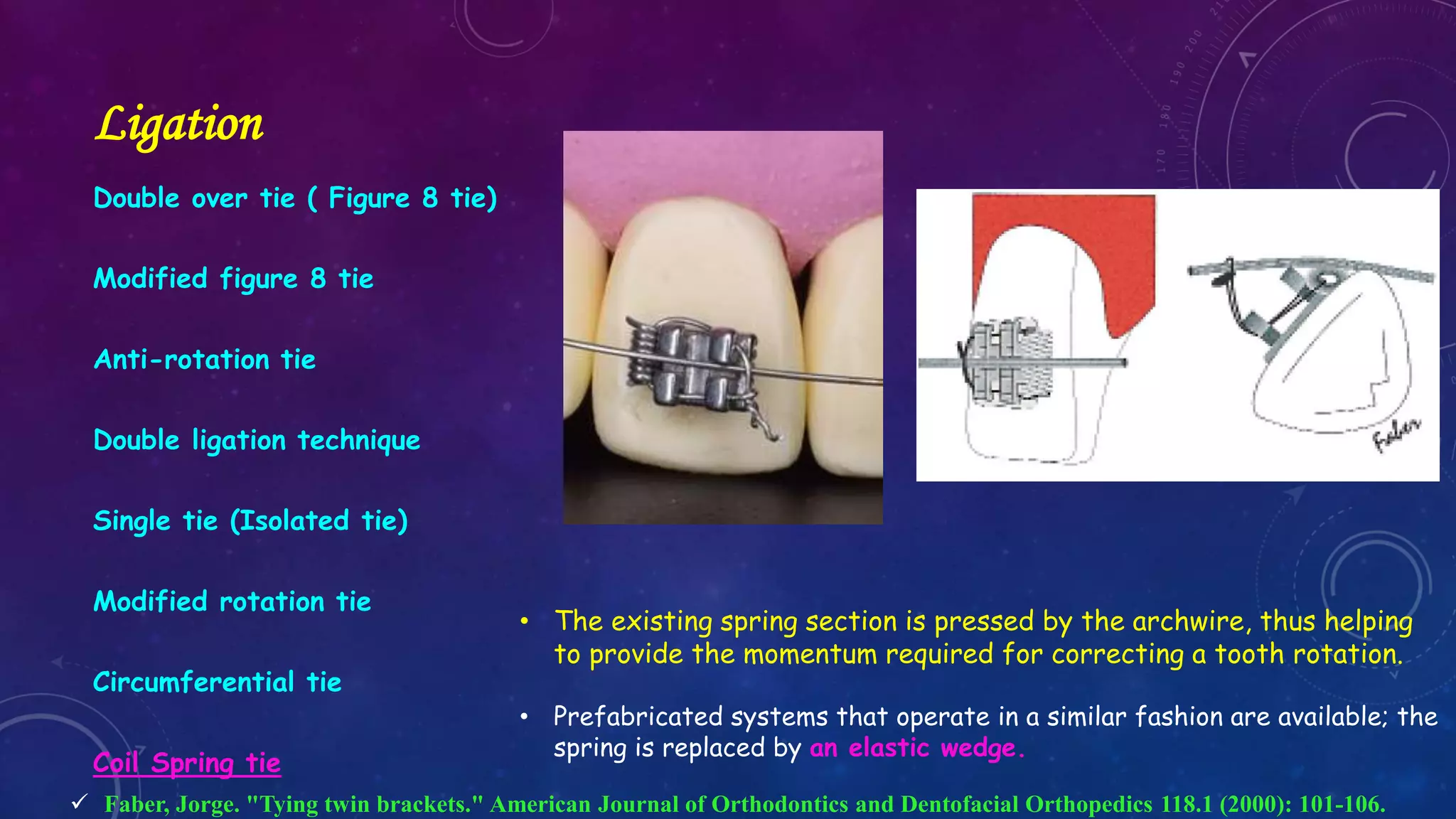 Orthodontic Correction of Rotated Teeth | PPTX