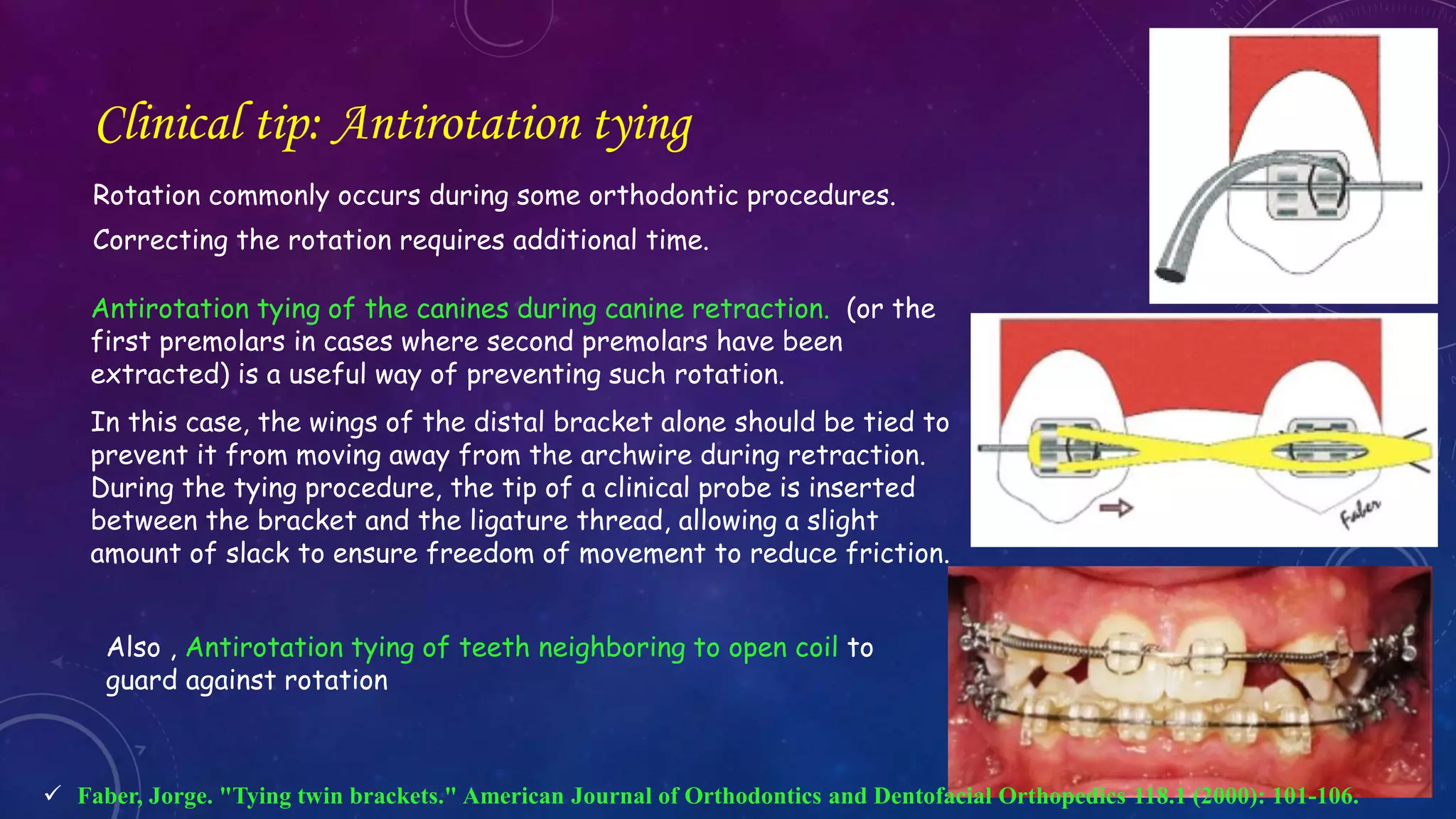 Orthodontic Correction of Rotated Teeth | PPTX