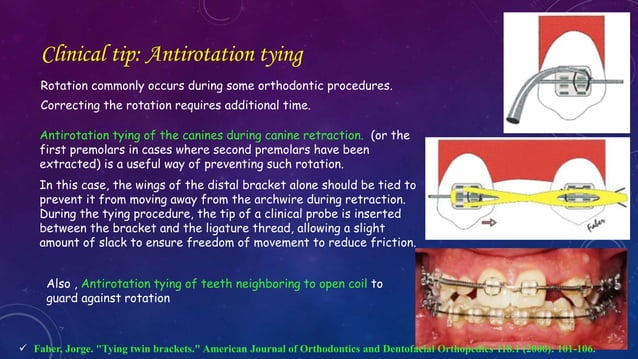Orthodontic Correction of Rotated Teeth | PPTX | Dental Health ...