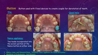 Orthodontic Correction of Rotated Teeth | PPTX
