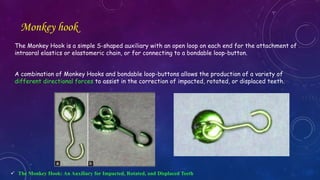 Orthodontic Correction of Rotated Teeth | PPTX