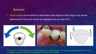 Orthodontic Correction of Rotated Teeth | PPT