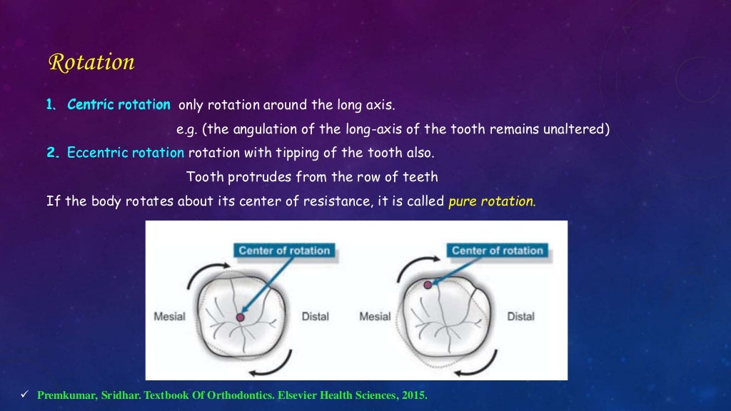 Orthodontic Correction of Rotated Teeth