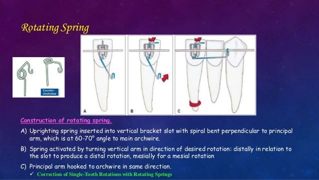 Orthodontic Correction of Rotated Teeth