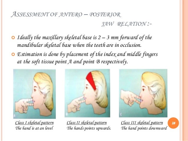 Orthodontic diagnosis