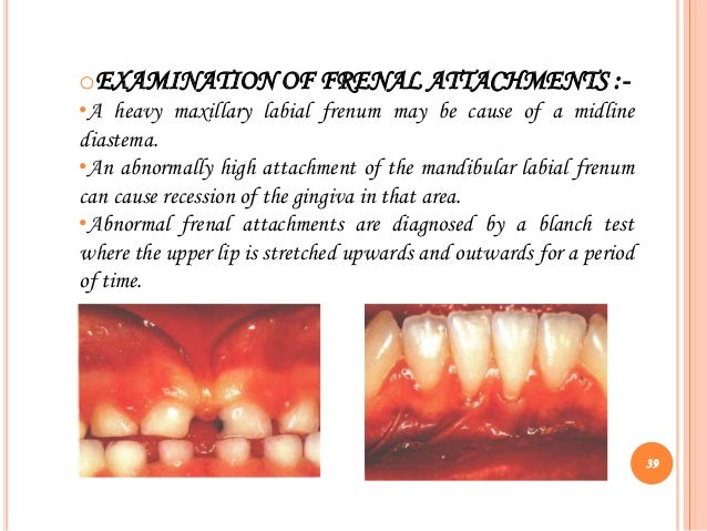 Orthodontic diagnosis