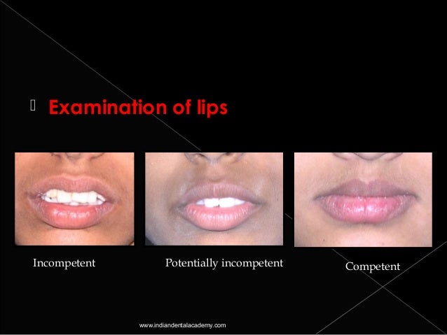 Orthodontic diagnosis /certified fixed orthodontic courses by Indian