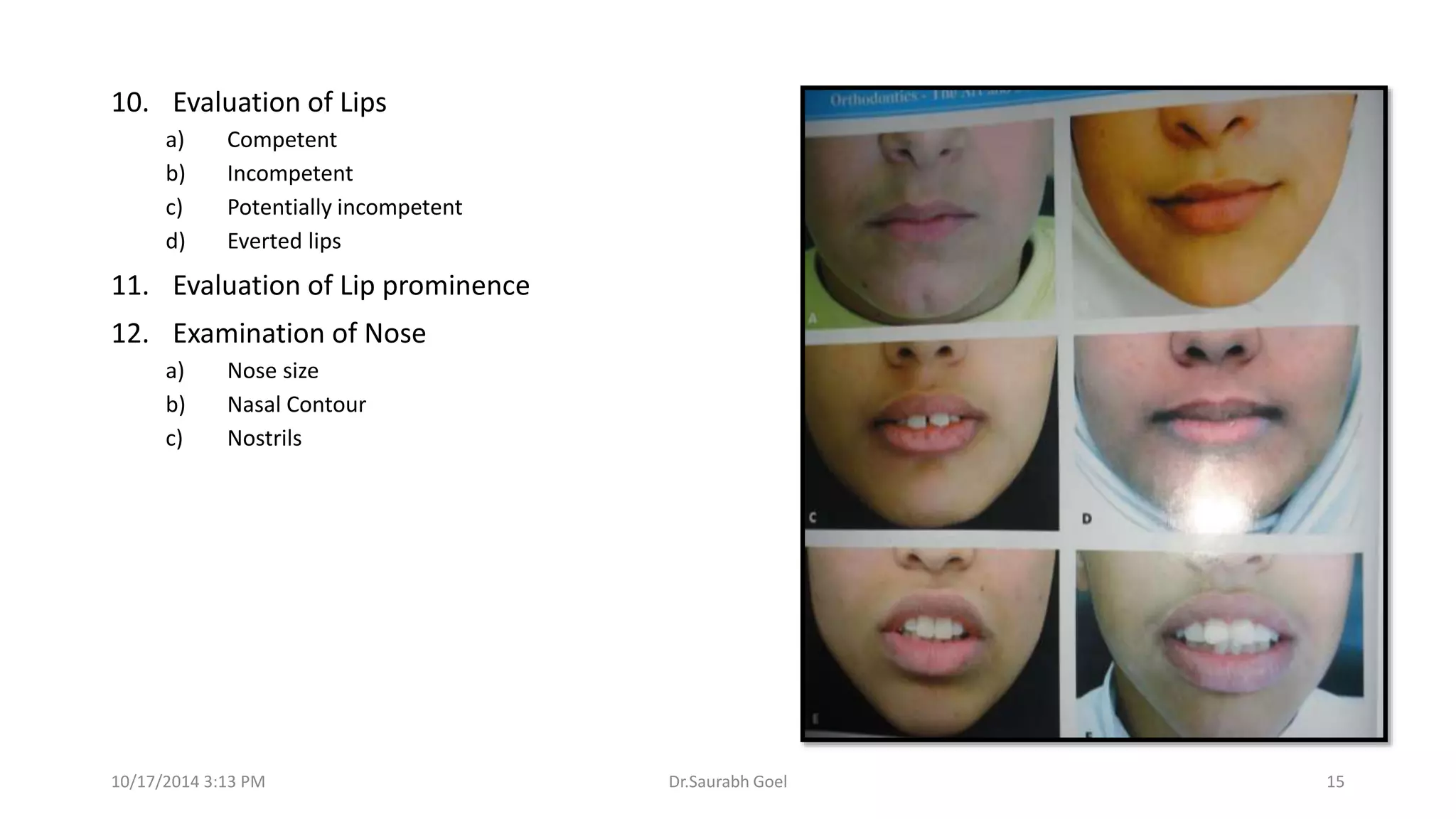 Orthodontic diagnosis | PPTX | Dental Health | Diseases and Conditions