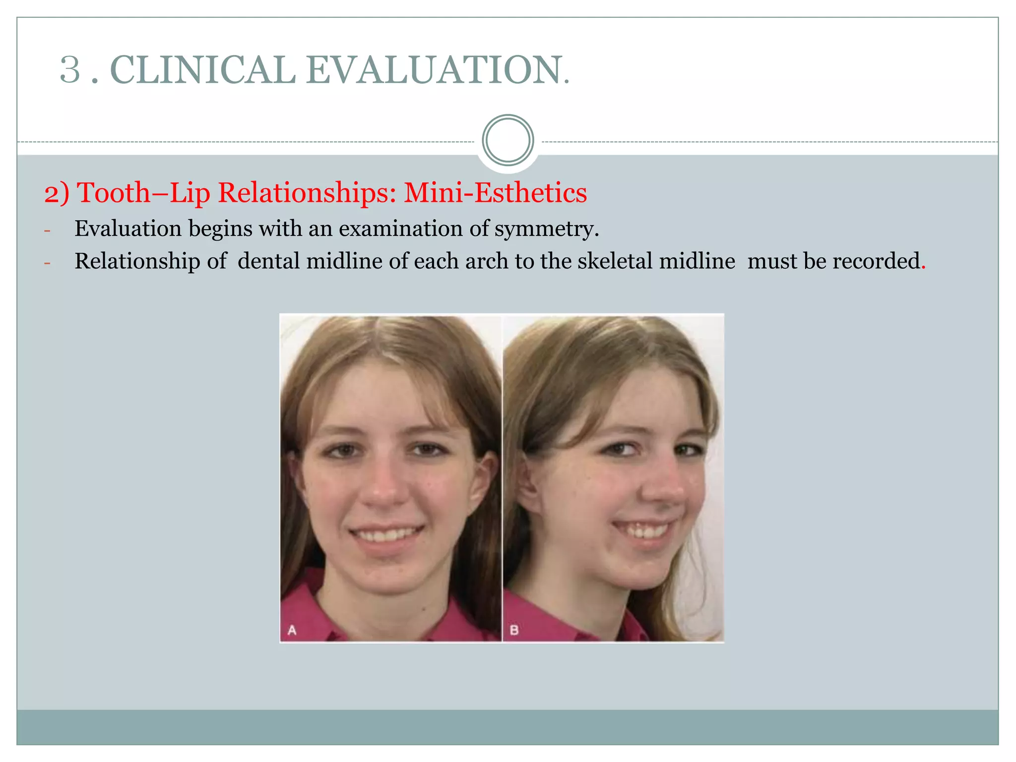 Orthodontic Diagnosis the problem oriented approach | PPTX