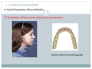Orthodontic Diagnosis the problem oriented approach | PPTX