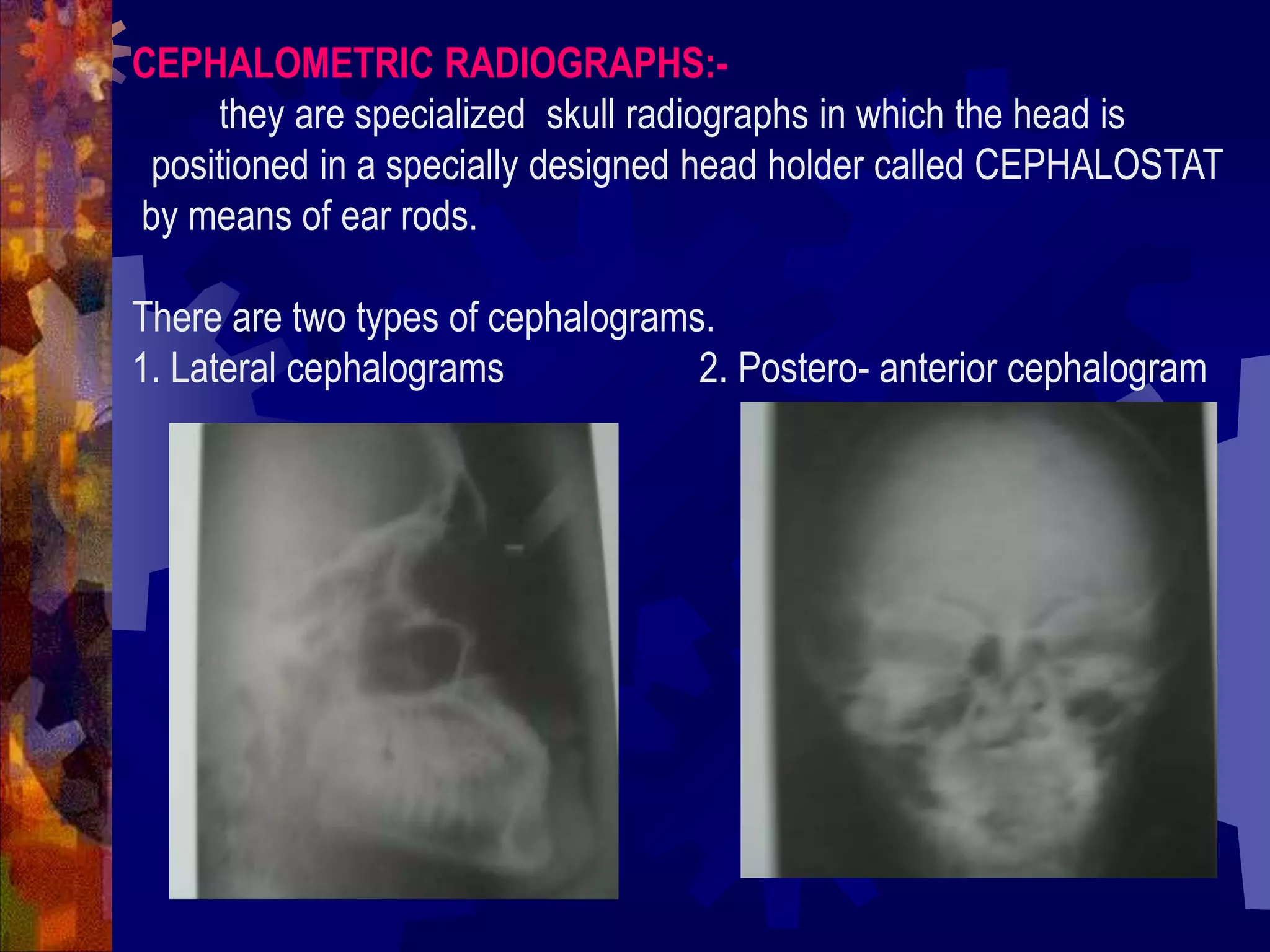 Orthodontic Diagnosis | PPT