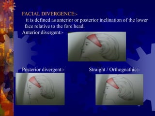 Orthodontic Diagnosis | PPT