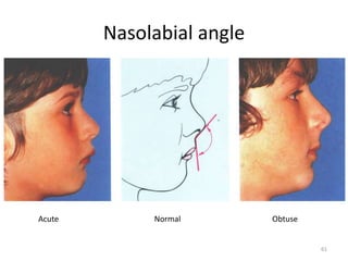 Orthodontic diagnosis | PPT