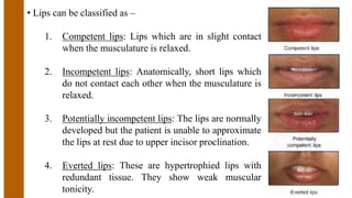Orthodontic diagnosis | PPT