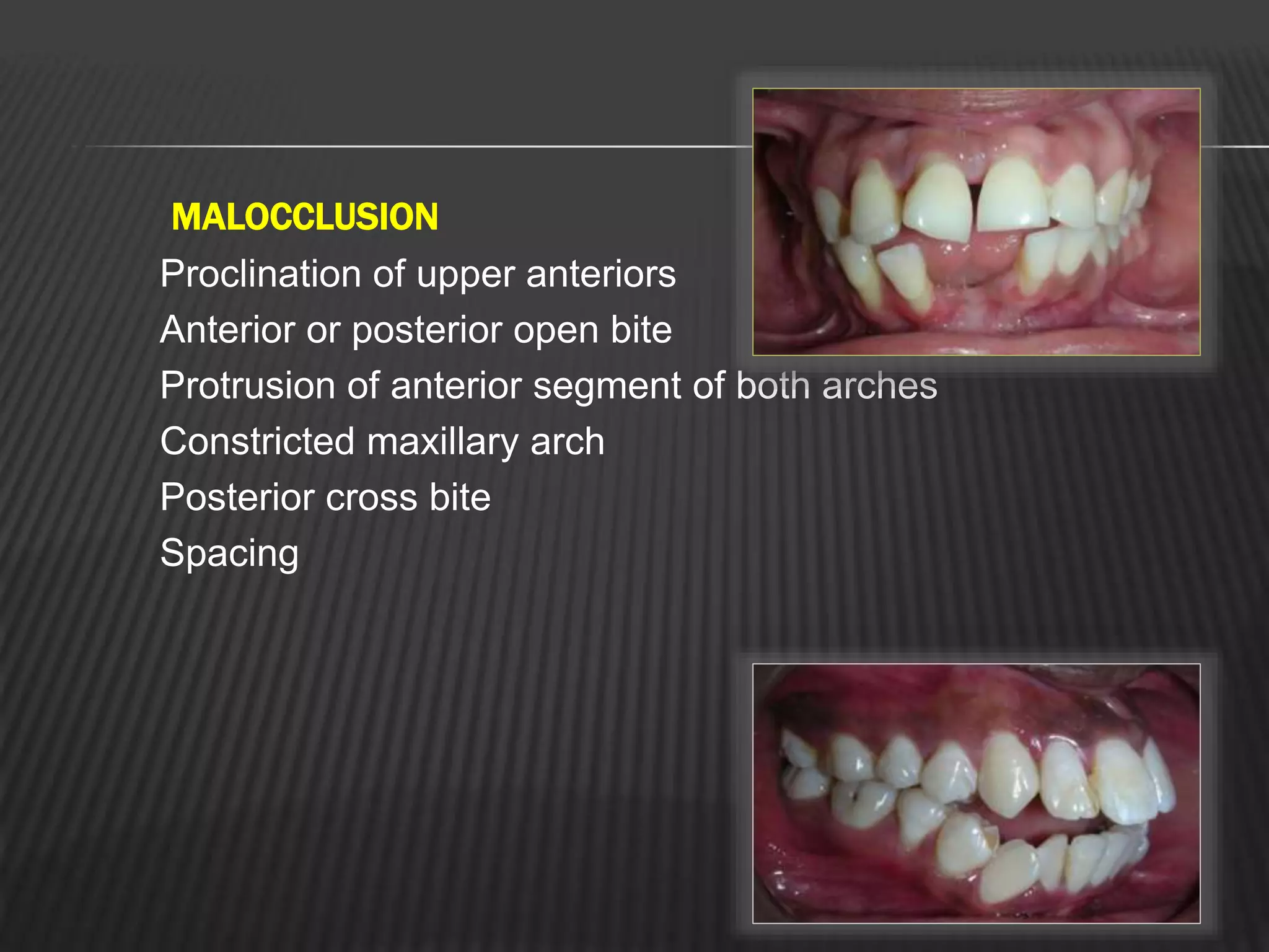Orthodontic diagnosis | PPTX