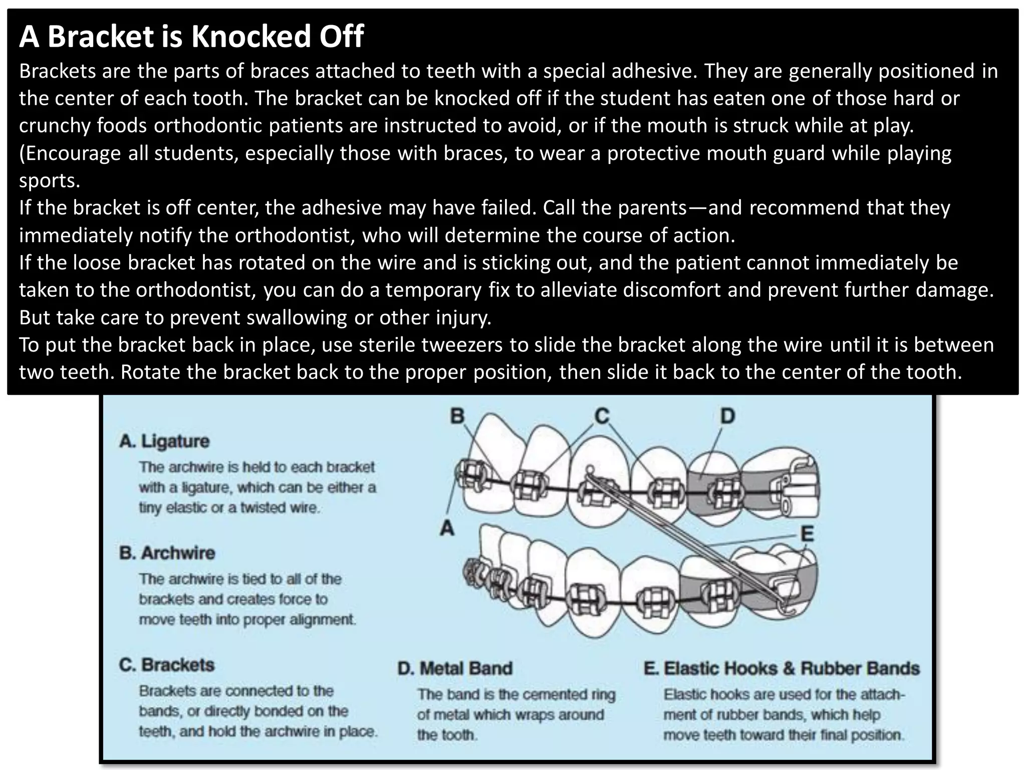 Orthodontic emergencies at hiremath orthodontics | PDF