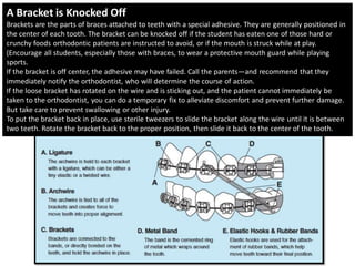 Orthodontic emergencies at hiremath orthodontics | PDF