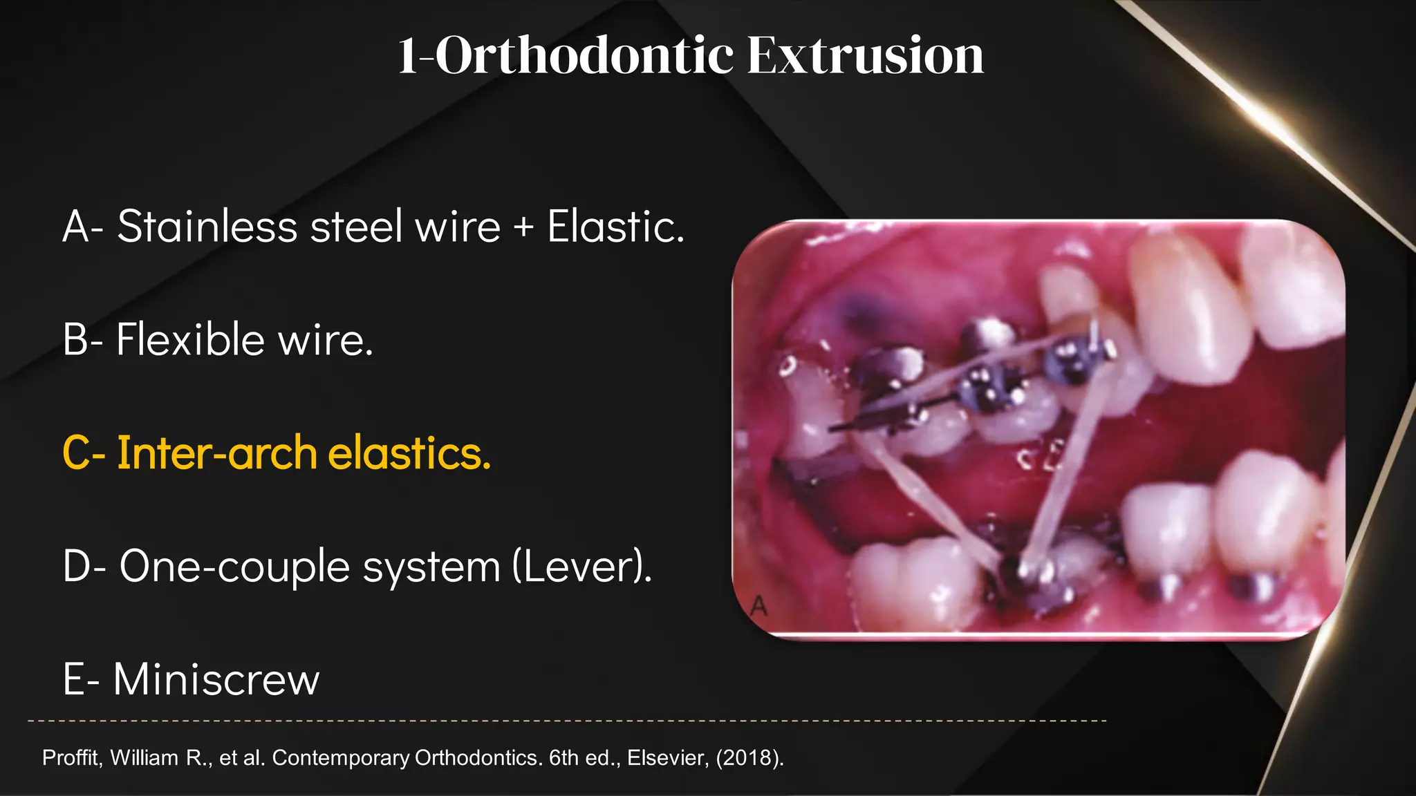 Orthodontic Extrusion | PDF