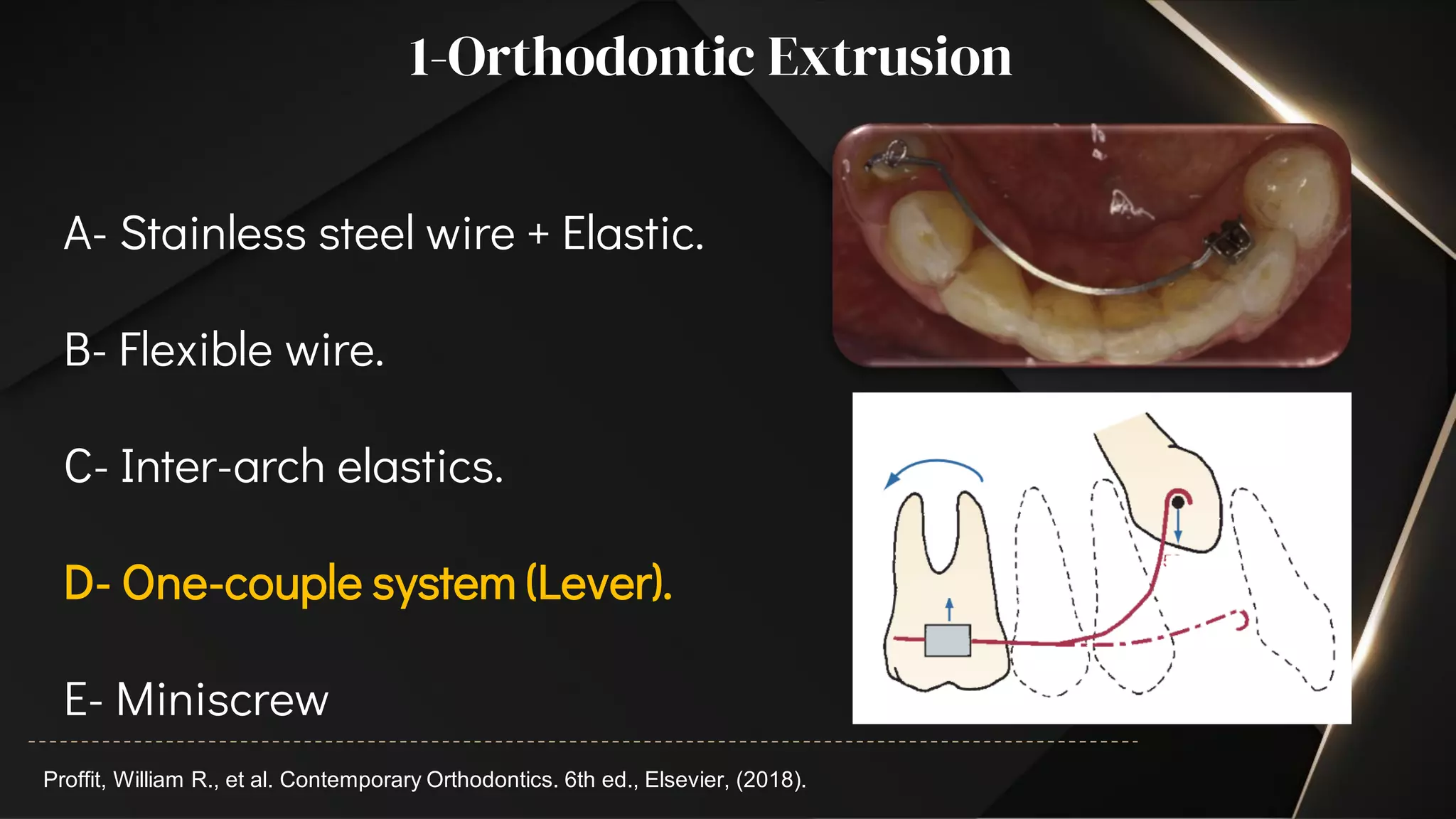Orthodontic Extrusion | PDF